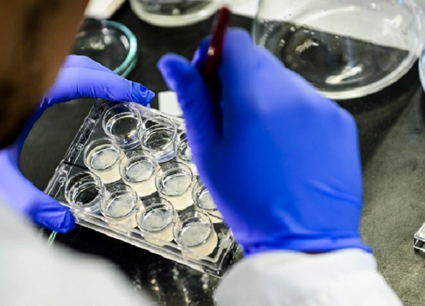 MEDIA COVERAGE – The STEM-PD Clinical Trial