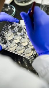 MEDIA COVERAGE – The STEM-PD Clinical Trial